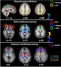 IASP PAIN, August 2019 – PainSA